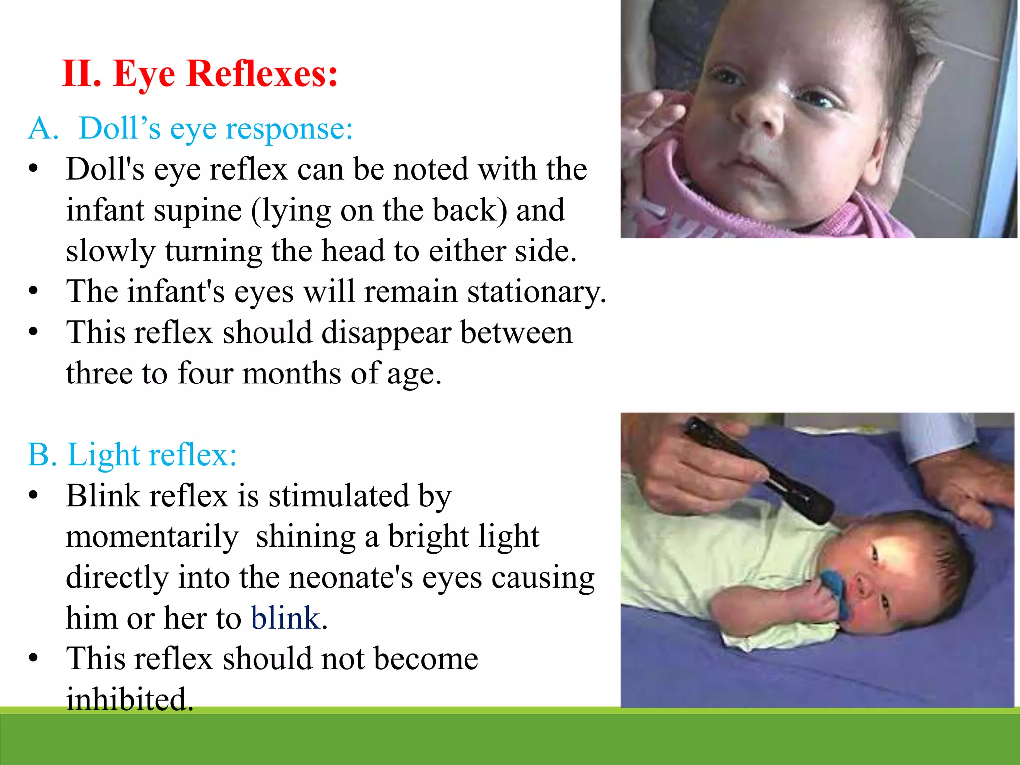 Lecture 5. Neonatal reflexes | PPTX