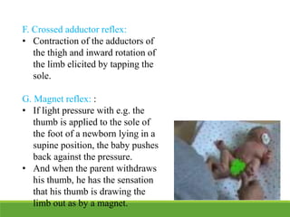 Lecture 5. Neonatal reflexes | PPTX