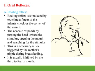 Lecture 5. Neonatal reflexes | PPTX