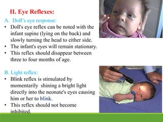 Lecture 5. Neonatal reflexes | PPTX