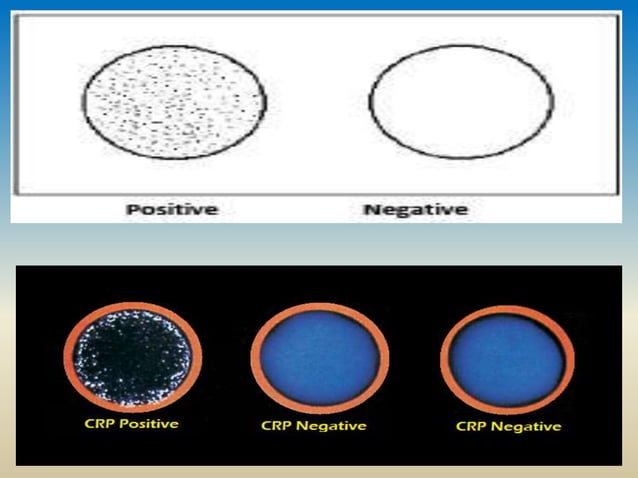 Lecture 7-c-reactive protein | PPTX