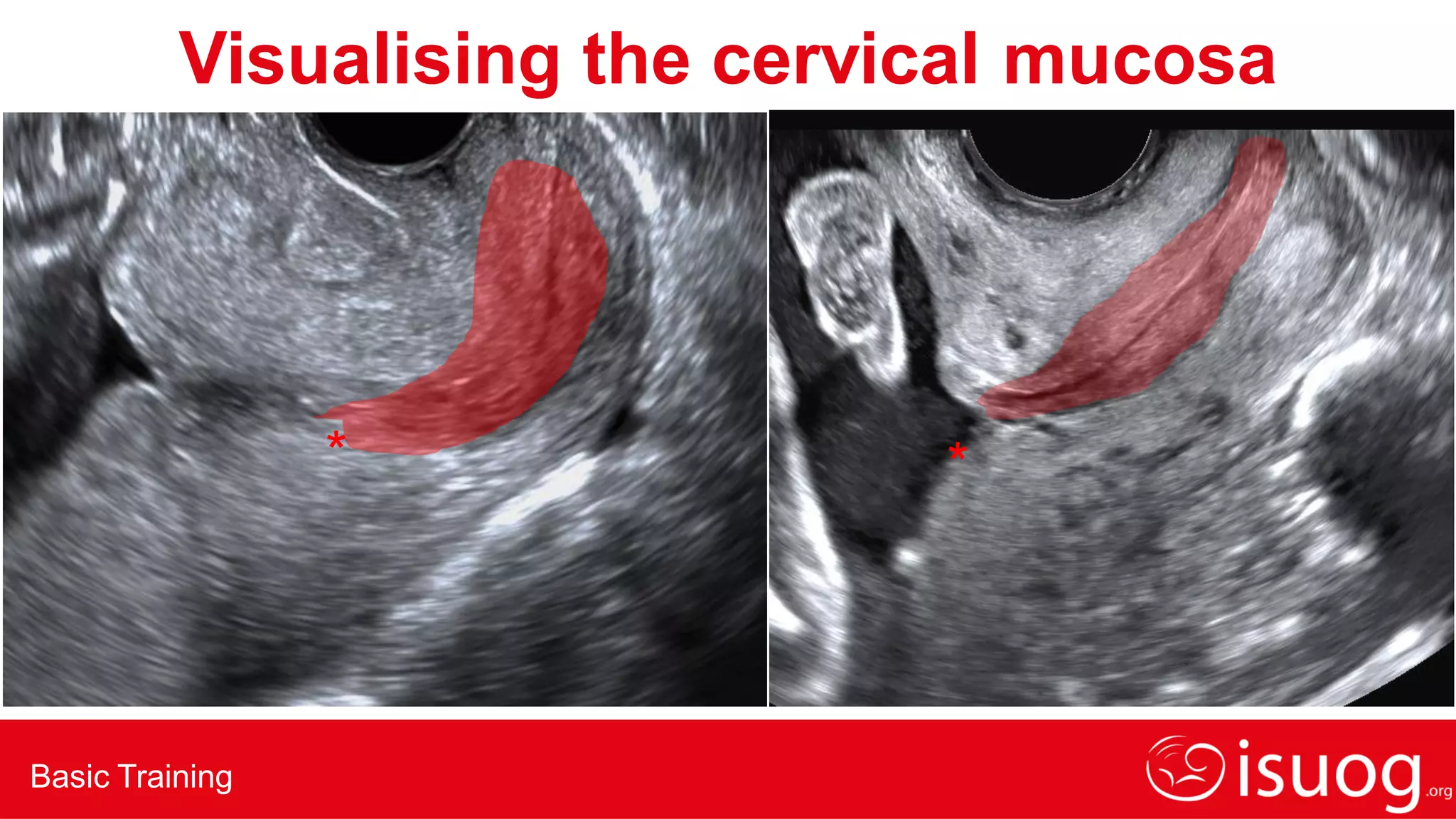 Lecture-8-Cervical-assessment.pdf