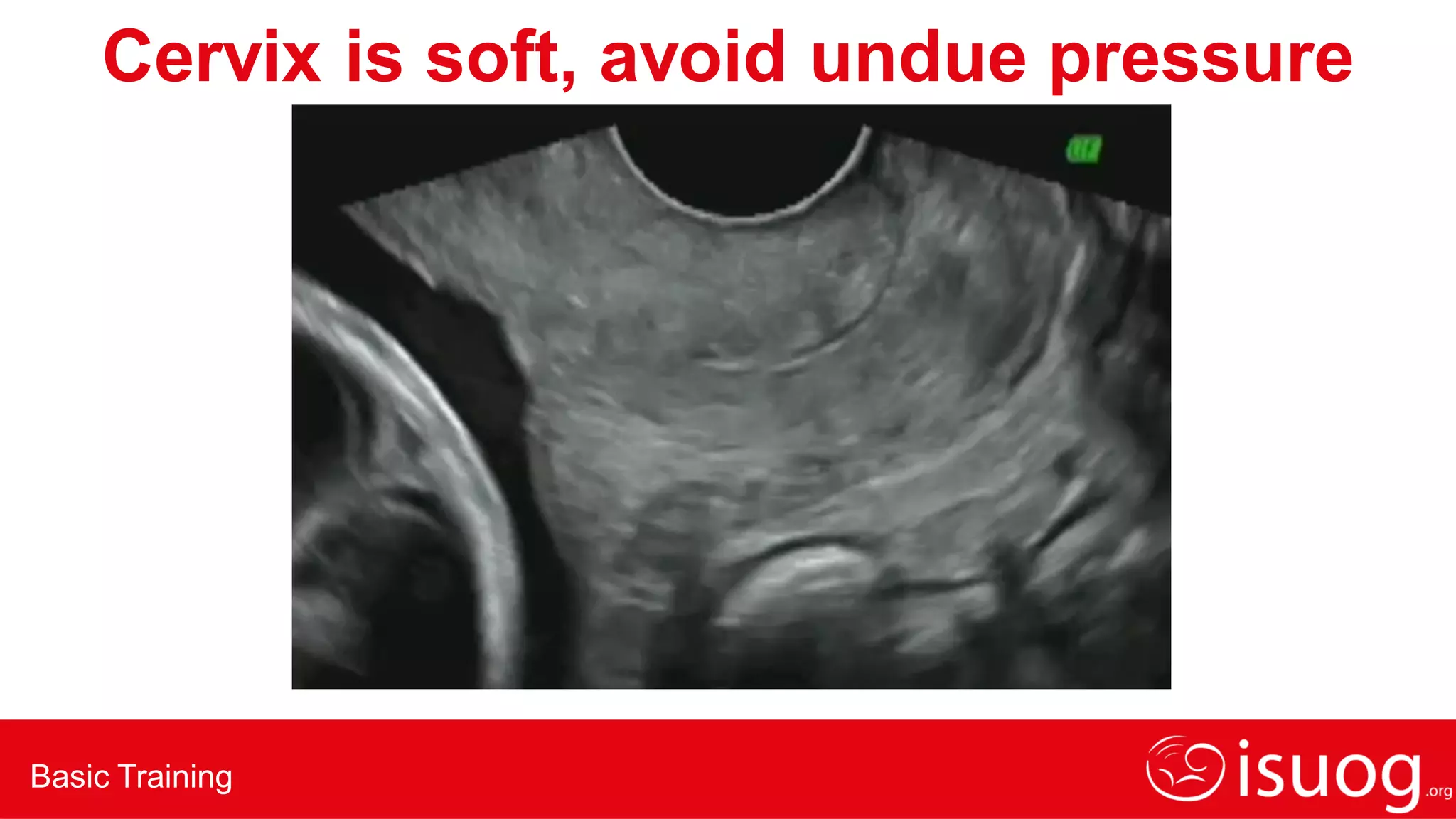 Lecture-8-Cervical-assessment.pdf