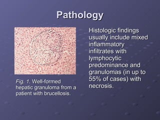 Lecture brucellosis 5 | PPT