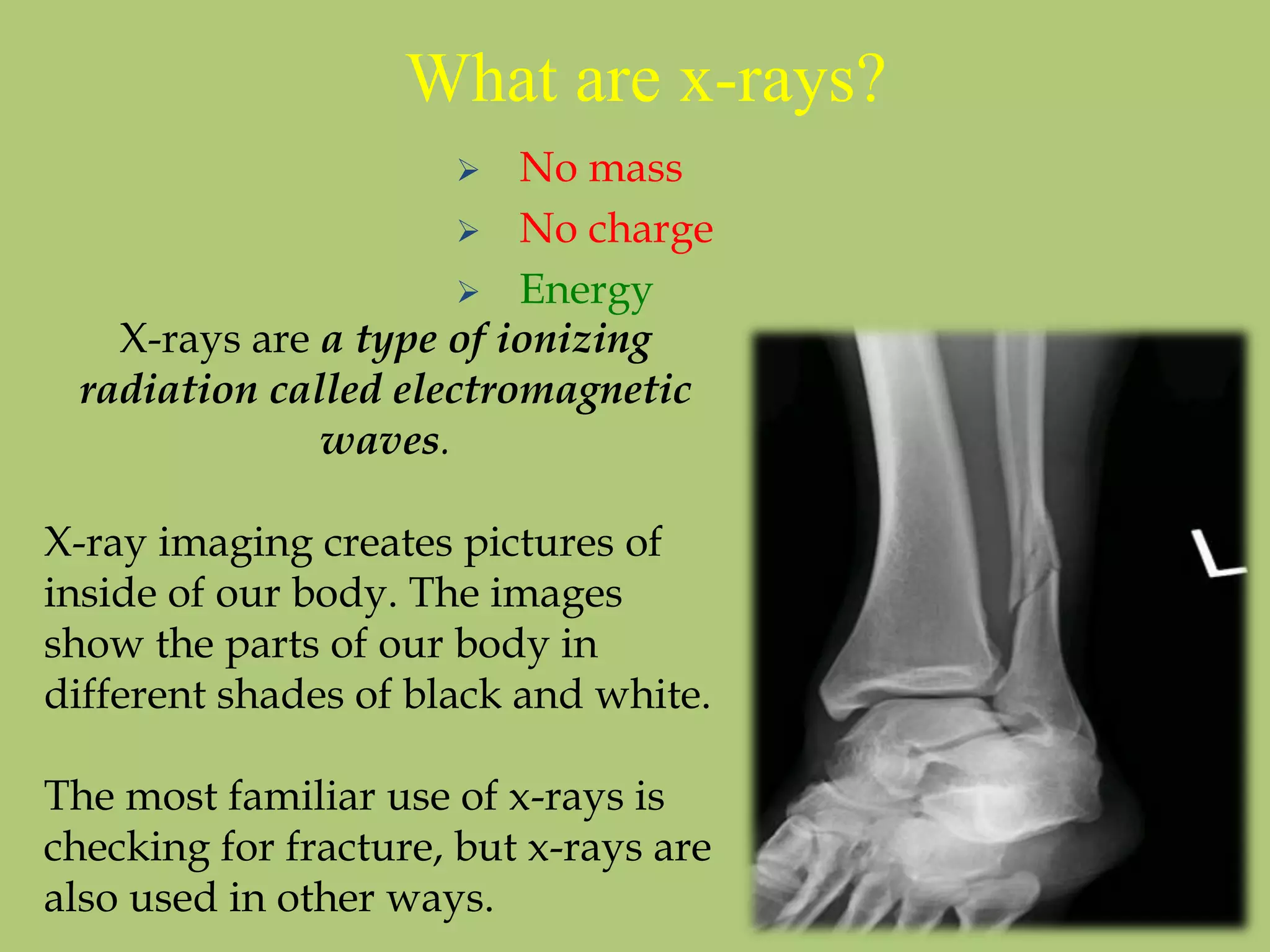 Lecture - 2 MBBS (x-ray modalities) | PPTX