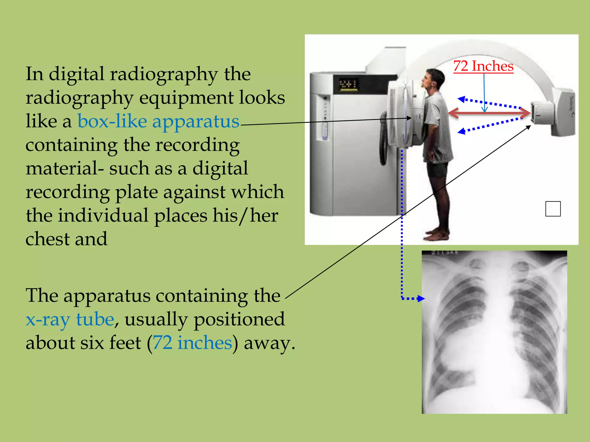 Lecture - 2 MBBS (x-ray modalities) | PPTX