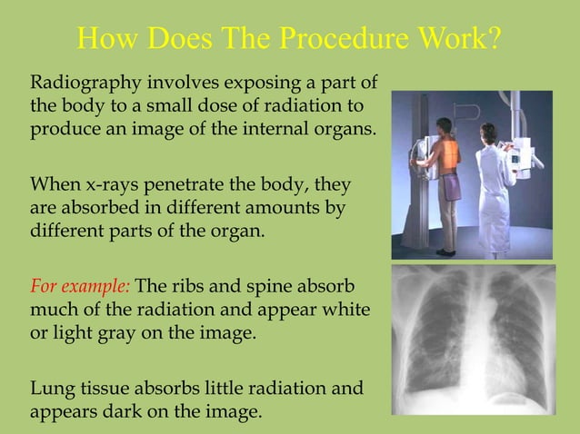 Lecture - 2 MBBS (x-ray modalities) | PPTX