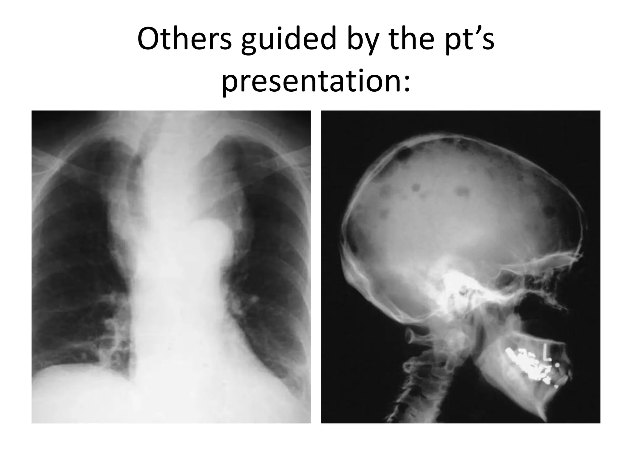 Lecture Thyroid Malignancies Pptx Thyroid Disorders Endocrine And Metabolic Diseases