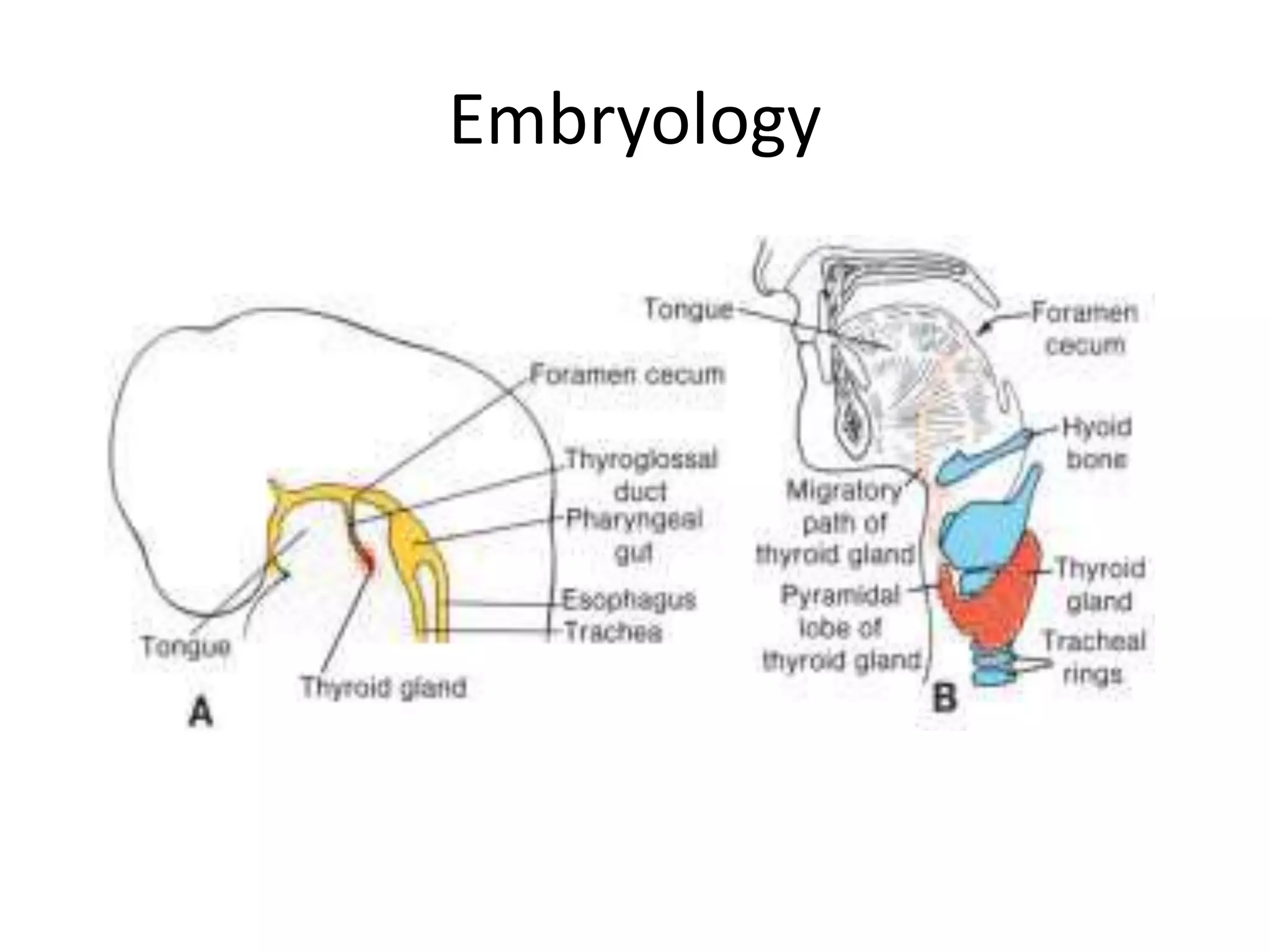Lecture Thyroid Malignancies Pptx Thyroid Disorders Endocrine And Metabolic Diseases