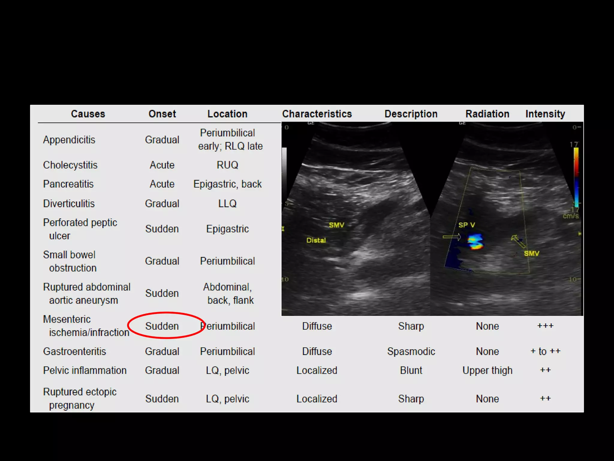 Emergency Ultrasound Course -Lecture 01 -Introduction to acute abdomen ...