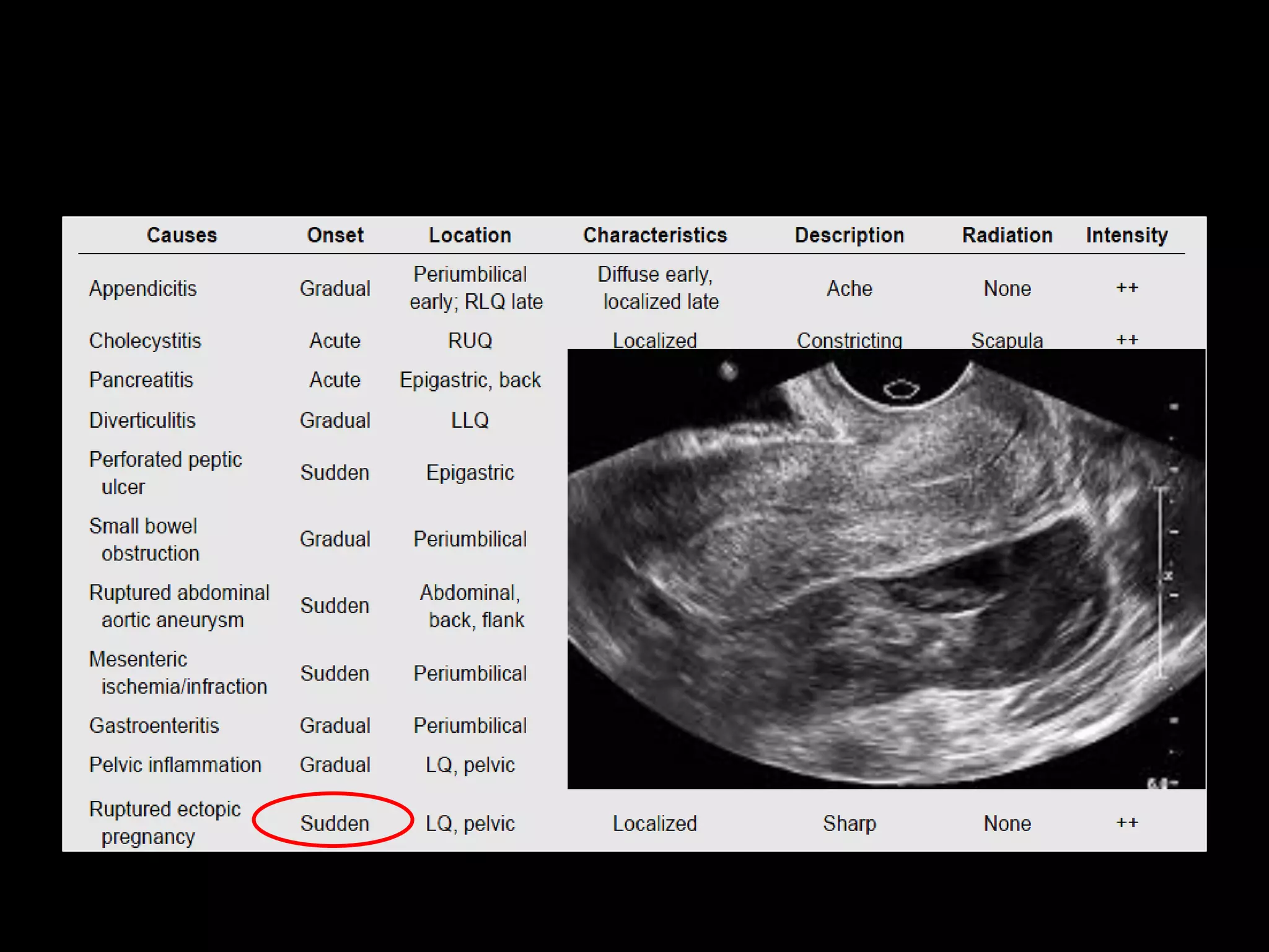 Emergency Ultrasound Course -Lecture 01 -Introduction to acute abdomen ...