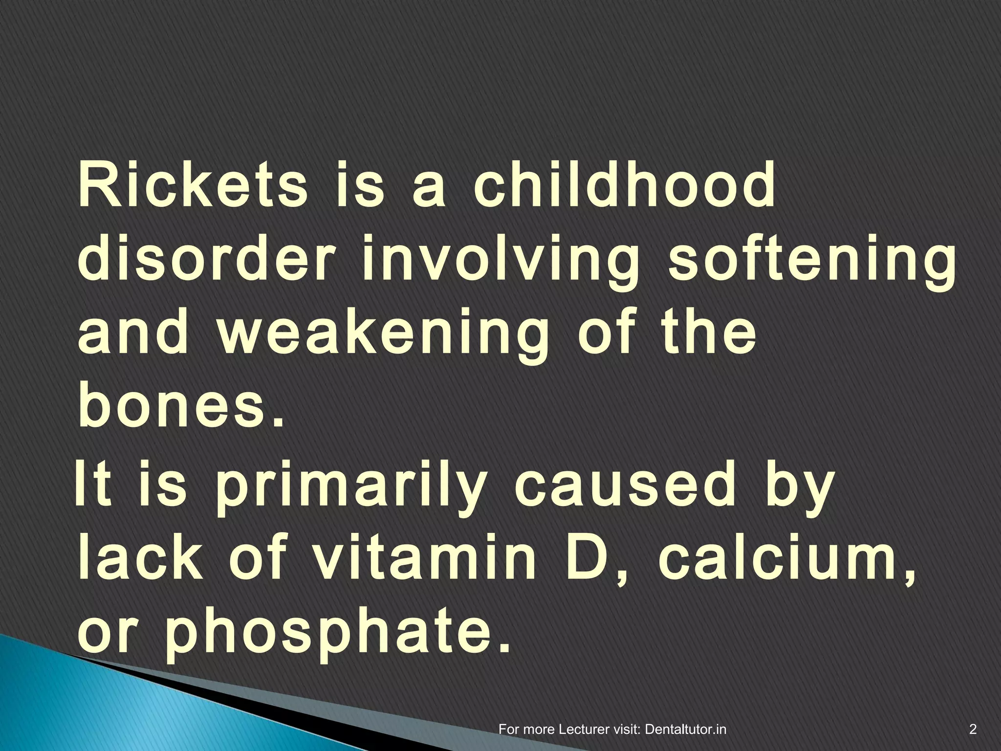 Lecture rickets | PPT