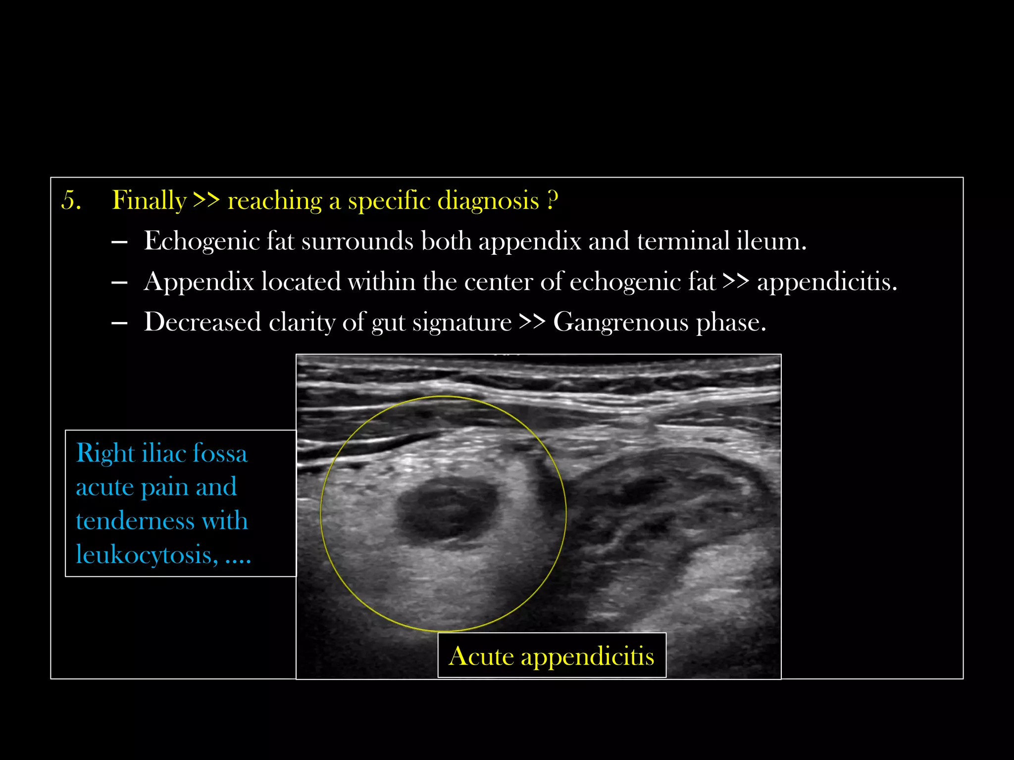 Emergency Ultrasound Course -Lecture 02 -Urgent sonographic signs -Part ...