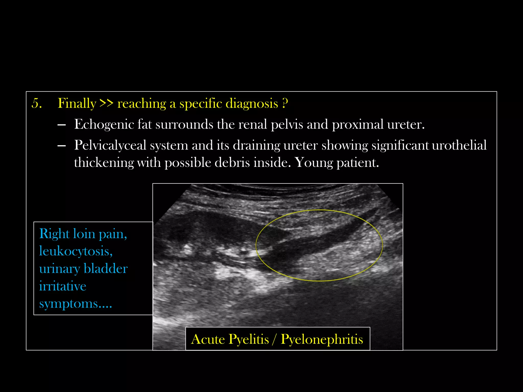 Emergency Ultrasound Course -Lecture 02 -Urgent sonographic signs -Part ...