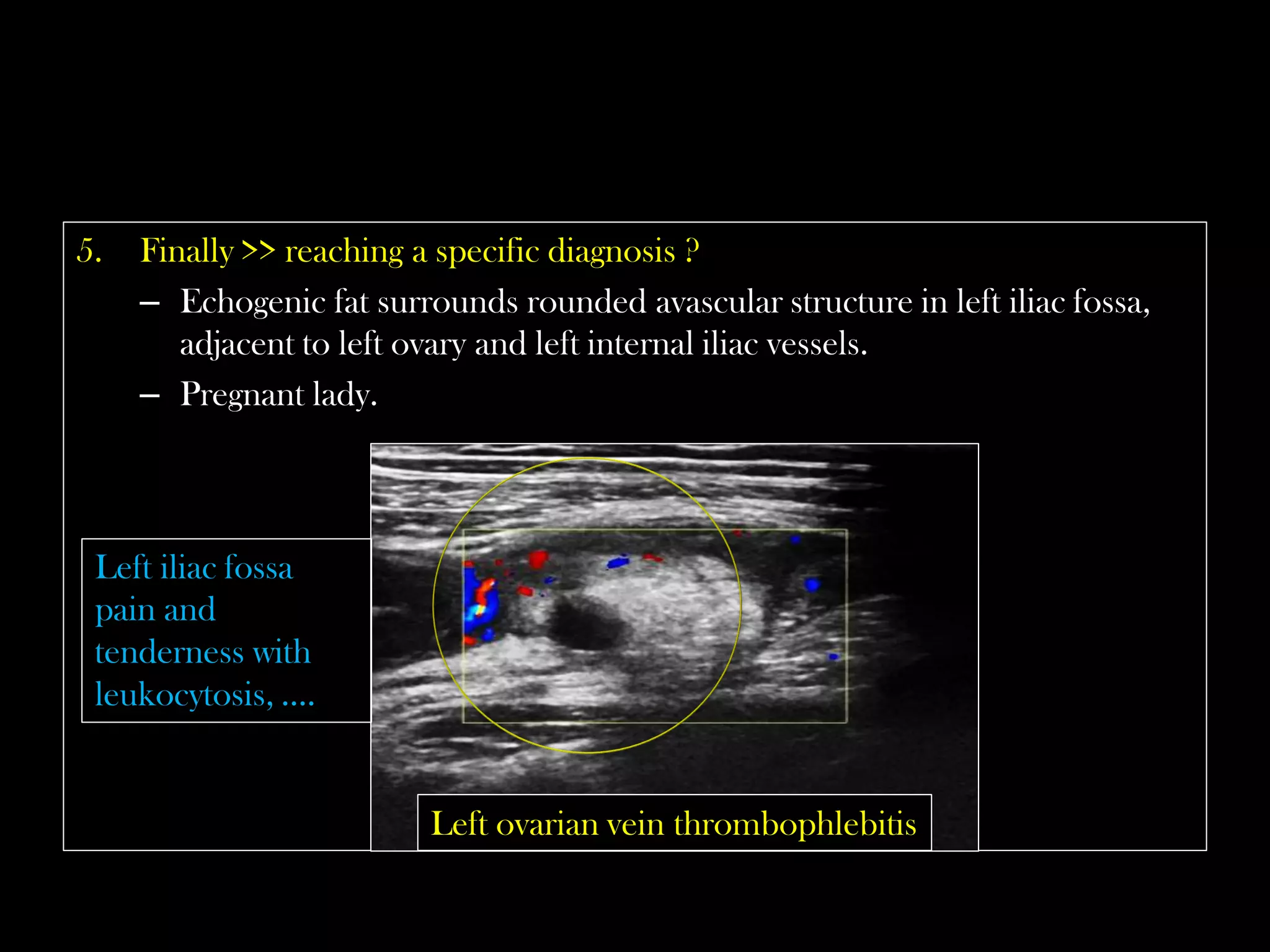 Emergency Ultrasound Course -Lecture 02 -Urgent sonographic signs -Part ...