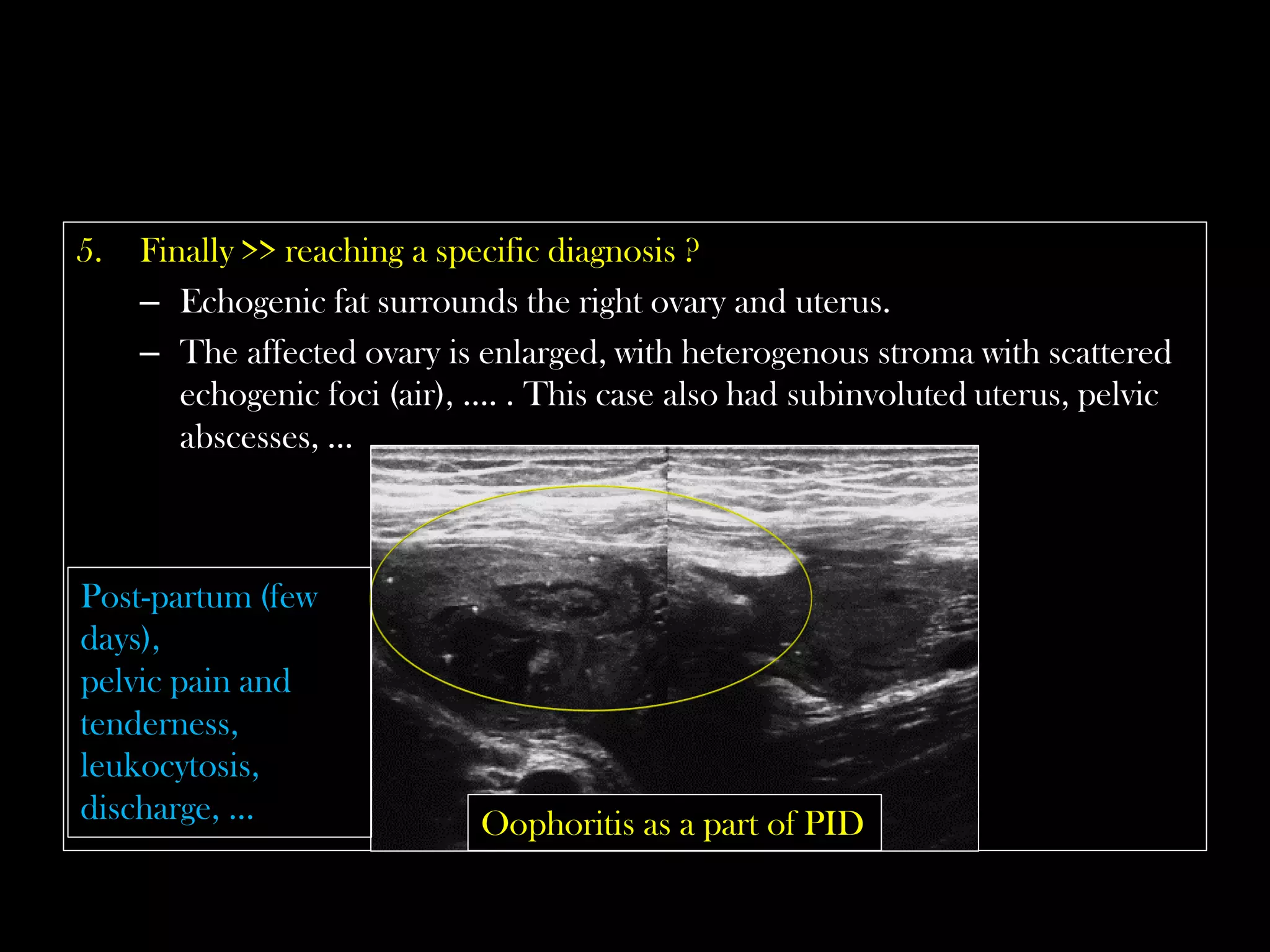 Emergency Ultrasound Course -Lecture 02 -Urgent sonographic signs -Part ...
