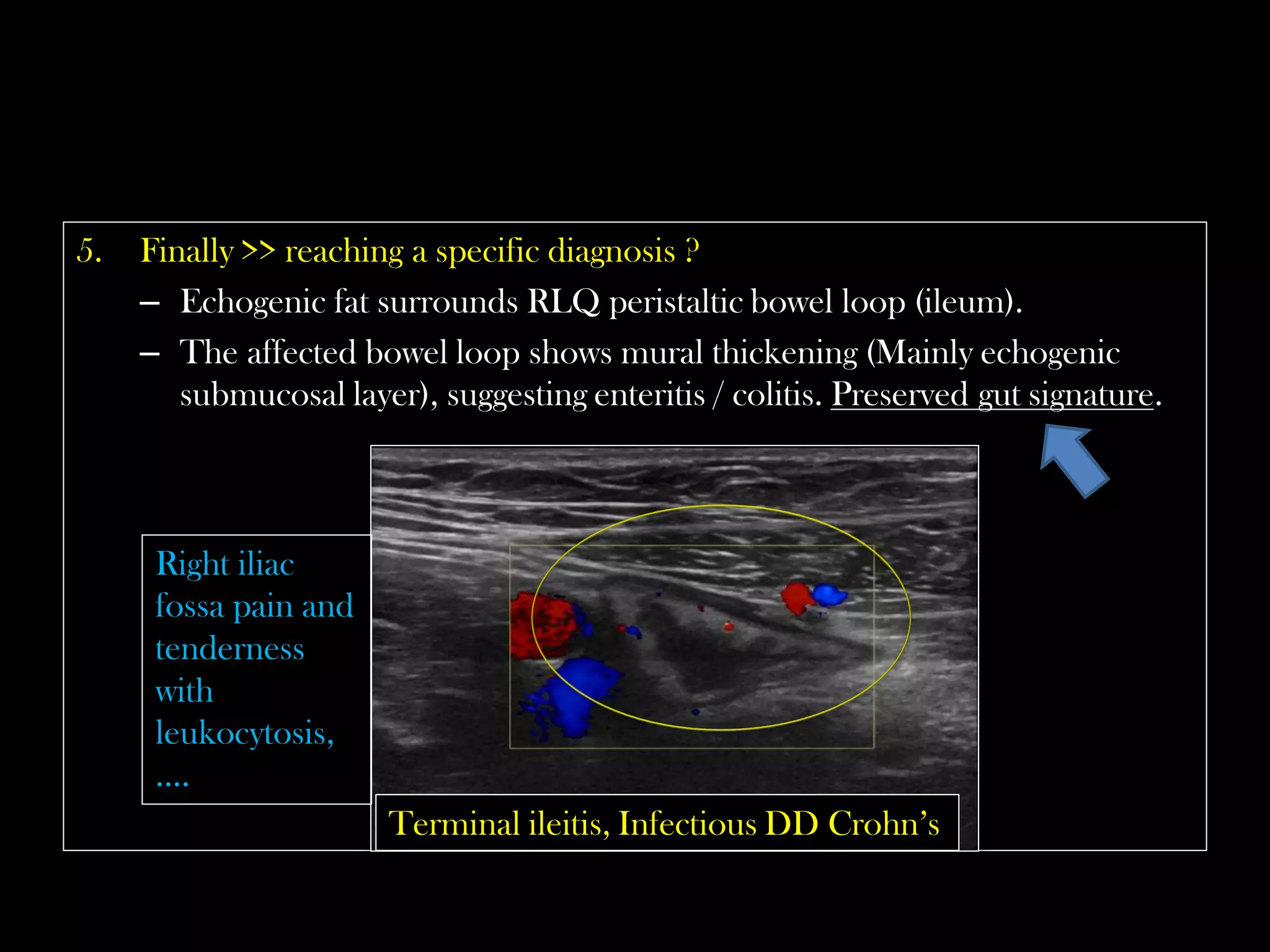 Emergency Ultrasound Course -Lecture 02 -Urgent sonographic signs -Part ...