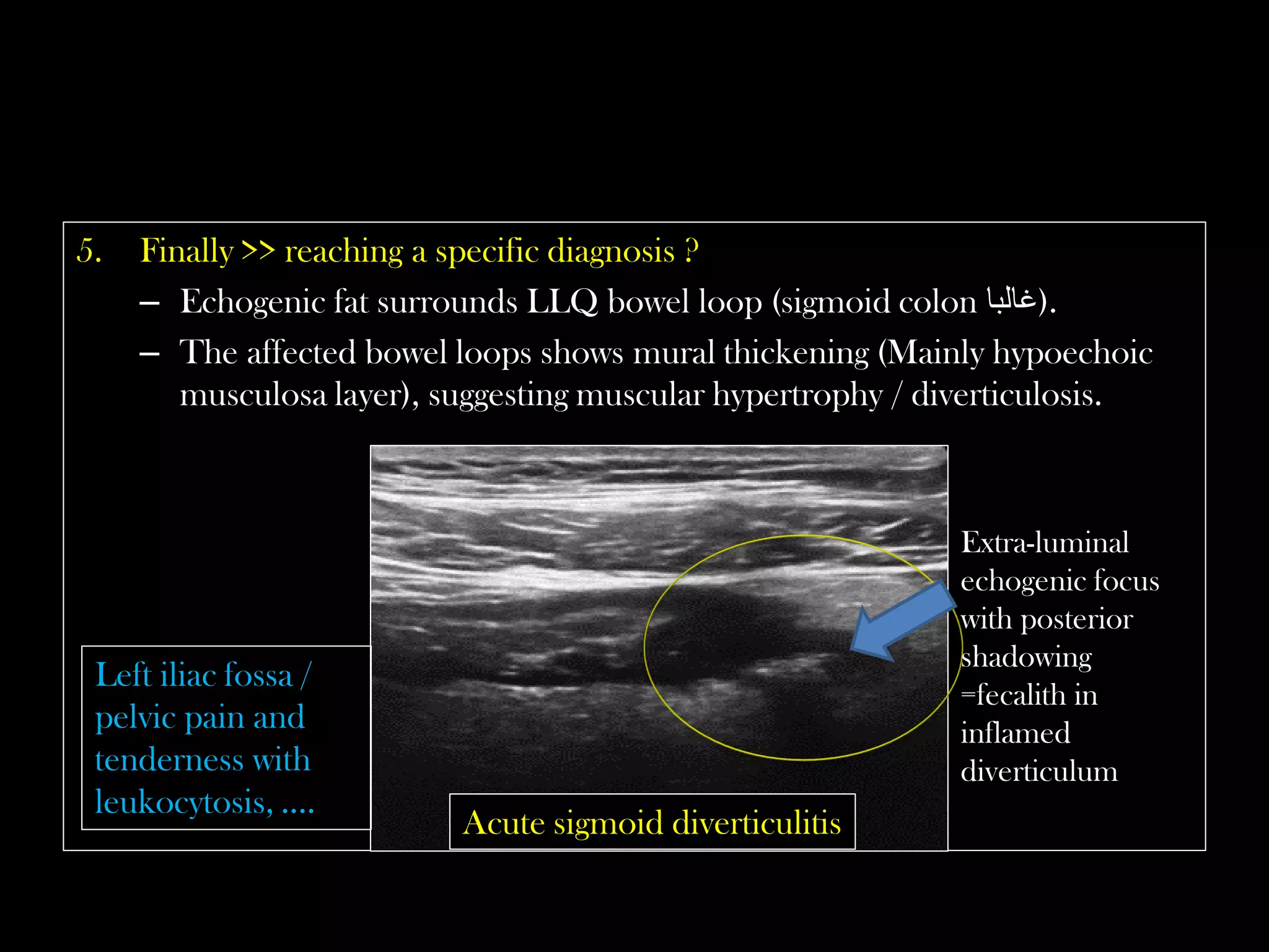 Emergency Ultrasound Course -Lecture 02 -Urgent sonographic signs -Part ...