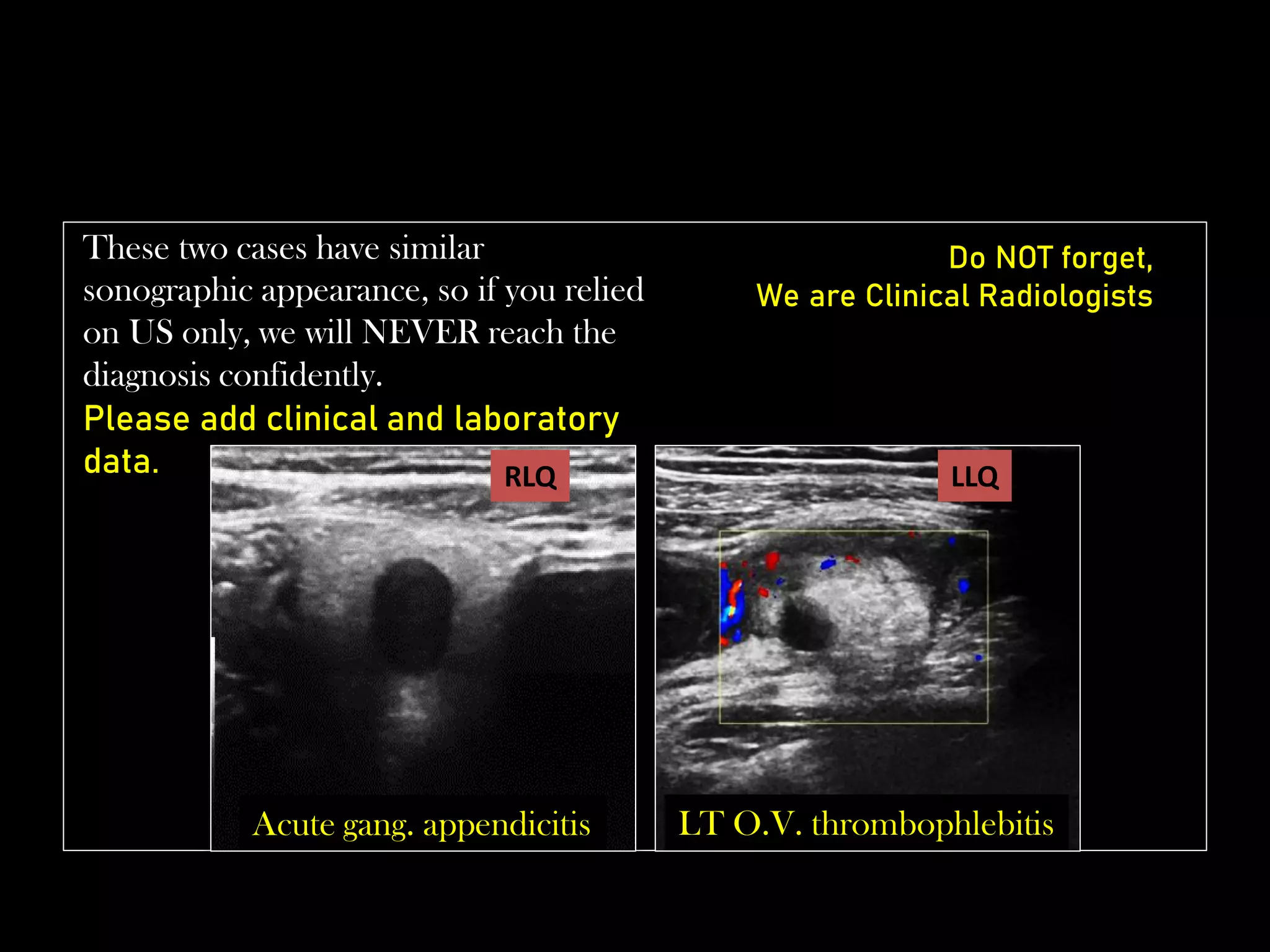Emergency Ultrasound Course -Lecture 02 -Urgent sonographic signs -Part ...