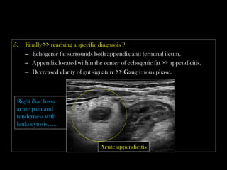 Emergency Ultrasound Course -Lecture 02 -Urgent sonographic signs -Part ...