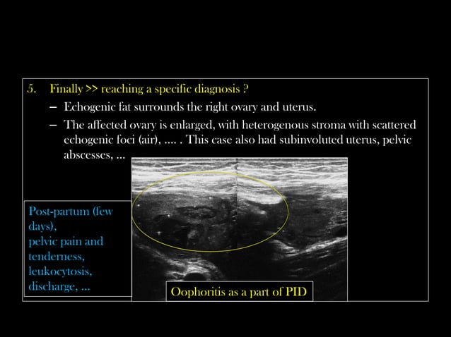 Emergency Ultrasound Course -Lecture 02 -Urgent sonographic signs -Part ...