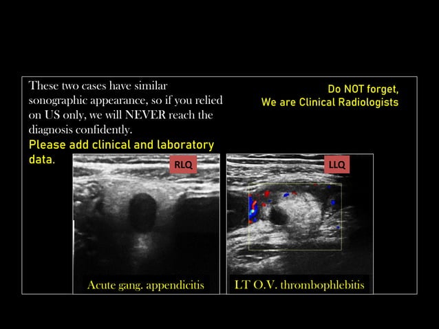 Emergency Ultrasound Course -Lecture 02 -Urgent sonographic signs -Part ...