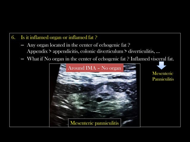 Emergency Ultrasound Course -Lecture 02 -Urgent sonographic signs -Part ...
