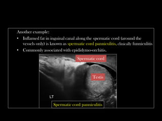 Emergency Ultrasound Course -Lecture 02 -Urgent sonographic signs -Part ...