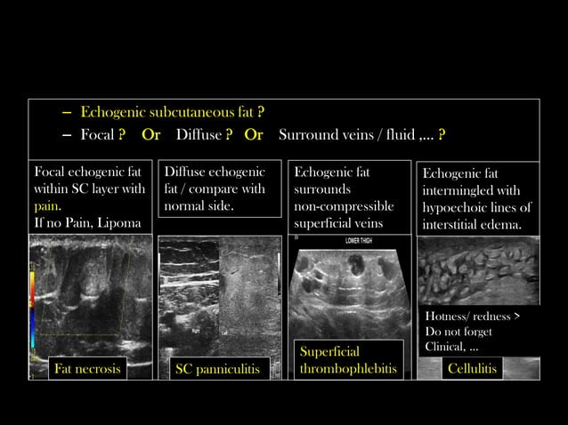 Emergency Ultrasound Course -Lecture 02 -Urgent sonographic signs -Part ...