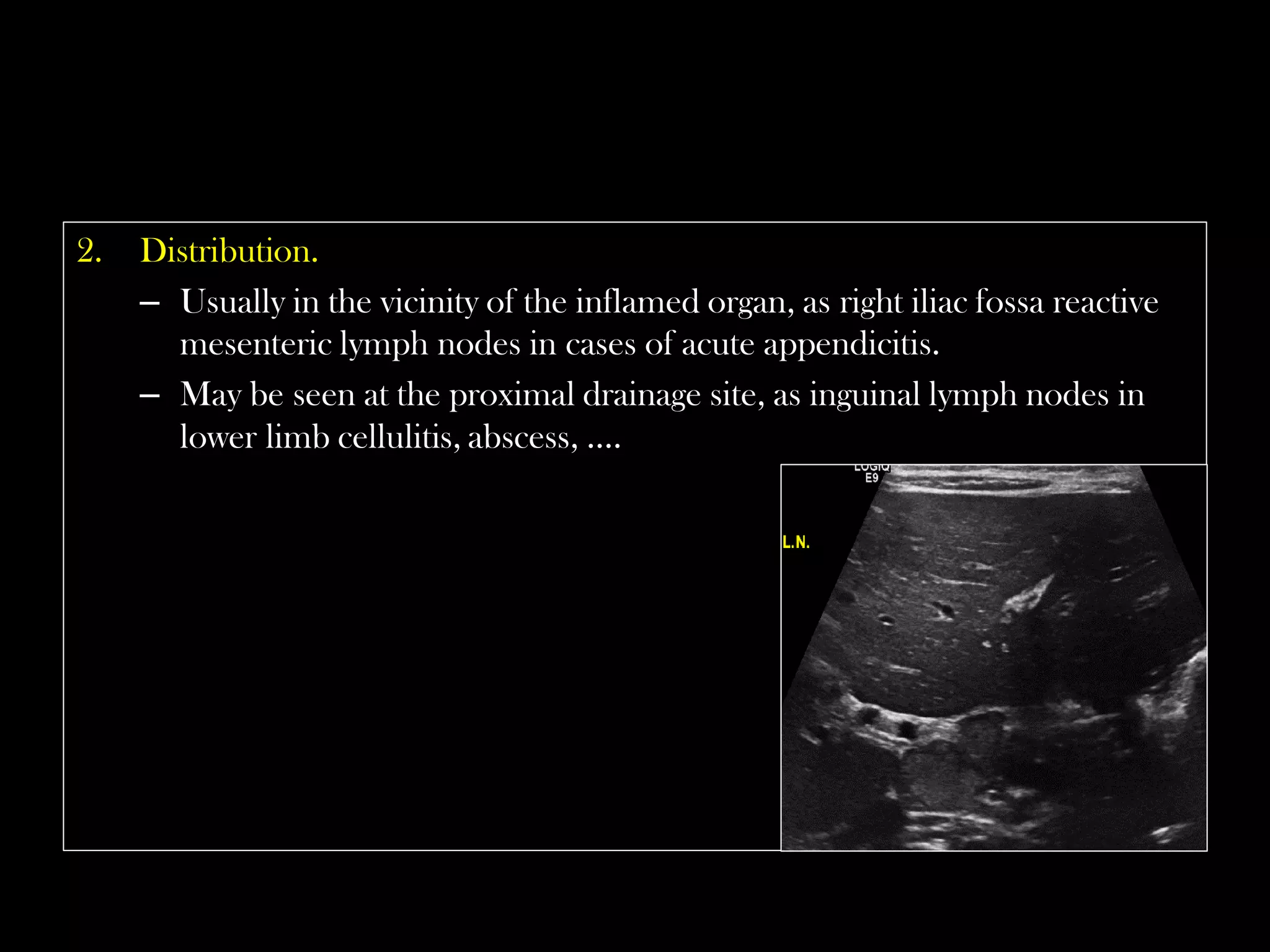 Emergency Ultrasound Course -Lecture 02 -Urgent sonographic signs -Part ...