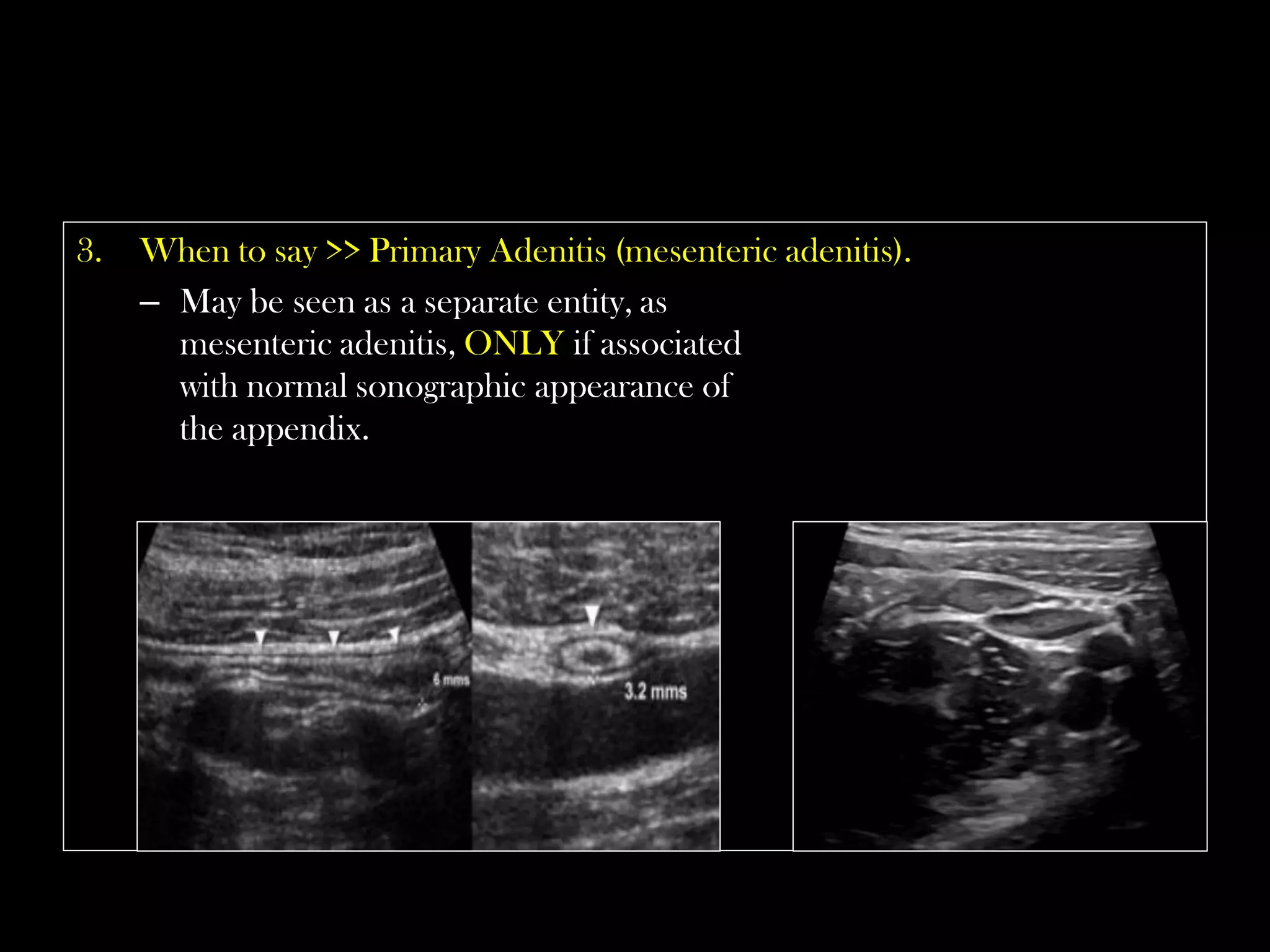 Emergency Ultrasound Course -Lecture 02 -Urgent sonographic signs -Part ...