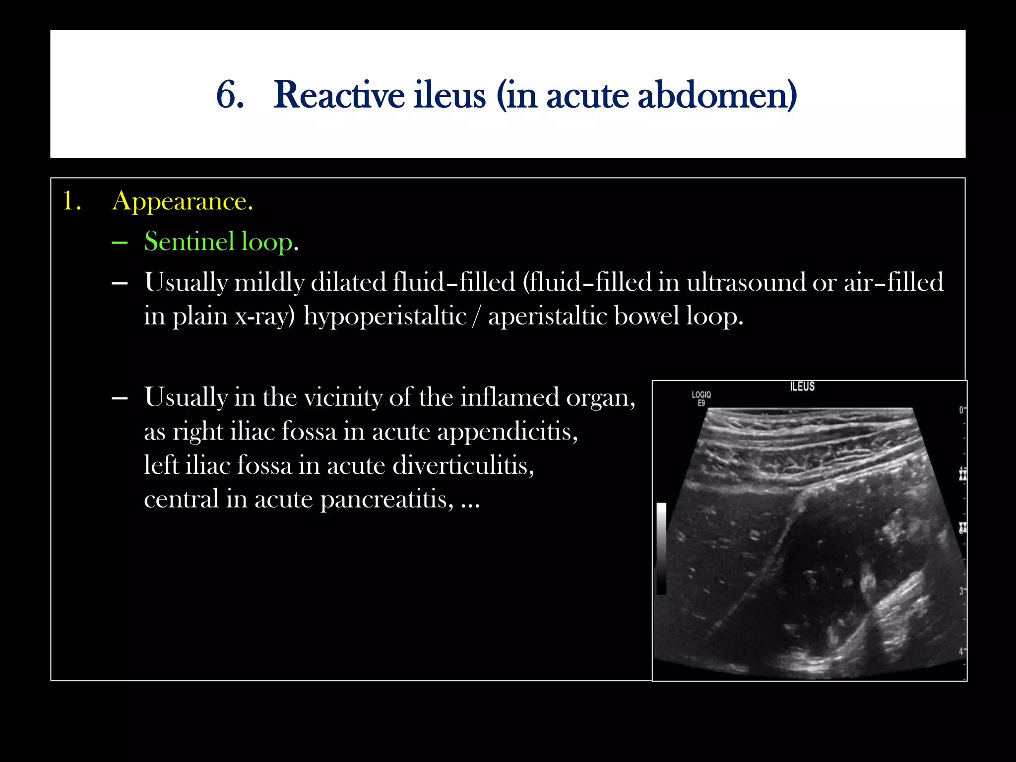 Emergency Ultrasound Course -Lecture 02 -Urgent sonographic signs -Part ...