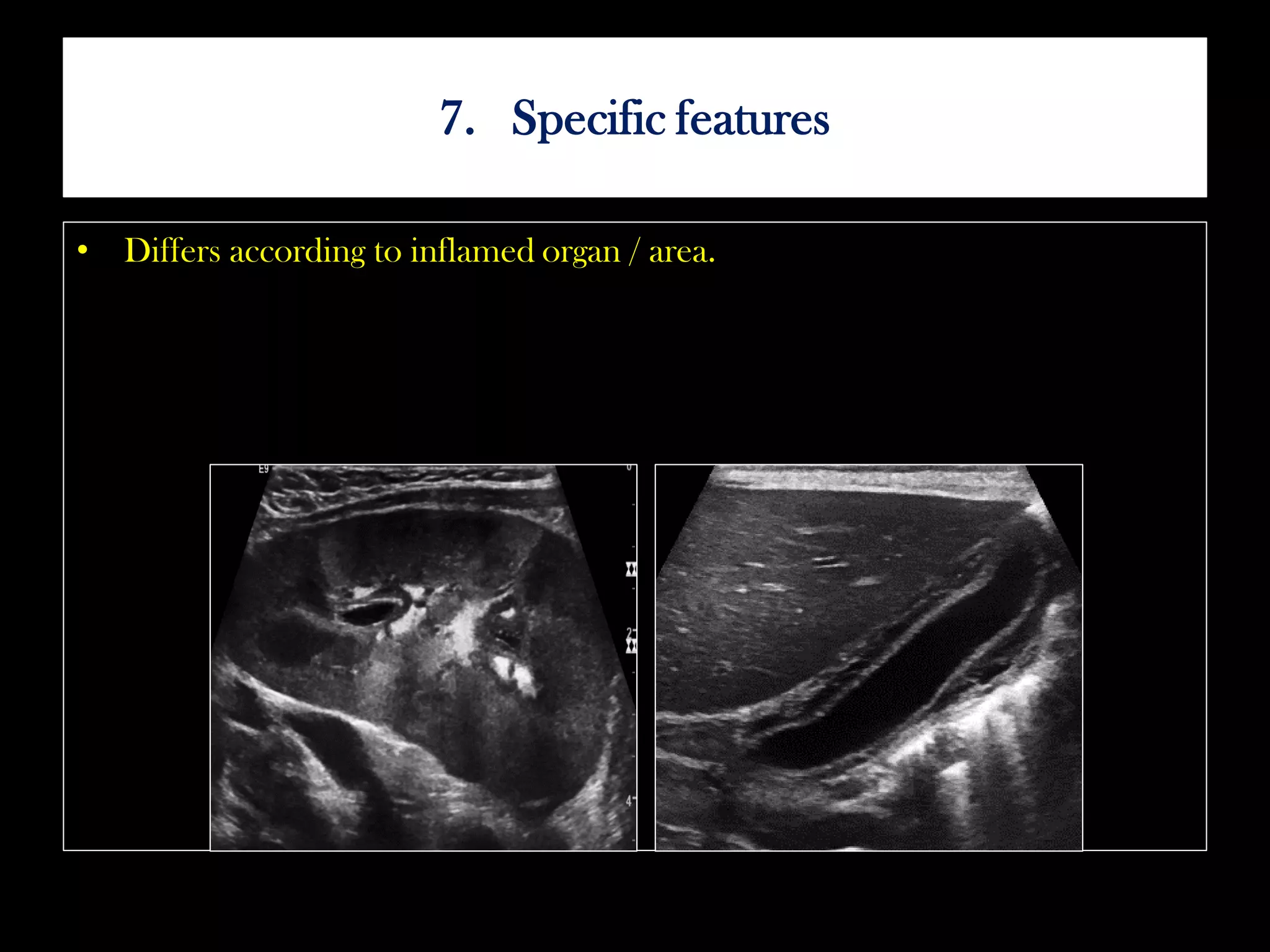 Emergency Ultrasound Course -Lecture 02 -Urgent sonographic signs -Part ...