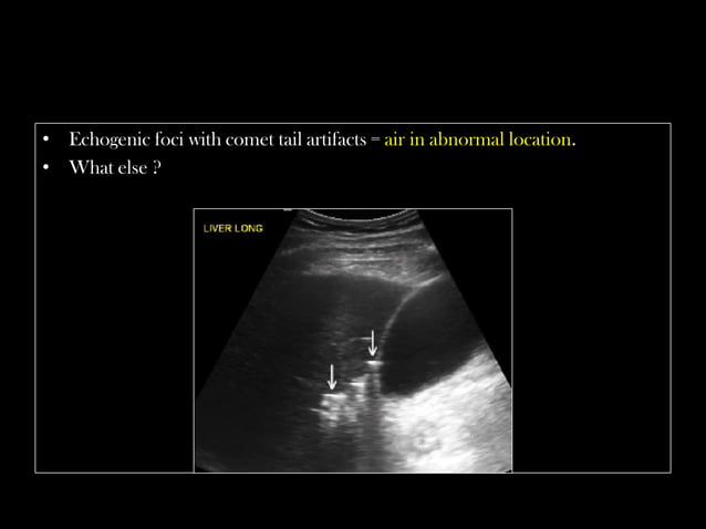 Emergency Ultrasound Course -Lecture 02 -Urgent sonographic signs -Part ...