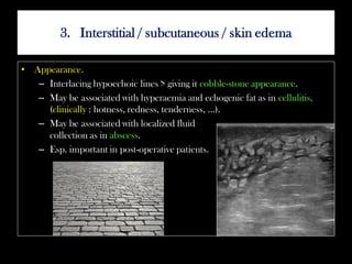 Emergency Ultrasound Course -Lecture 02 -Urgent sonographic signs -Part ...