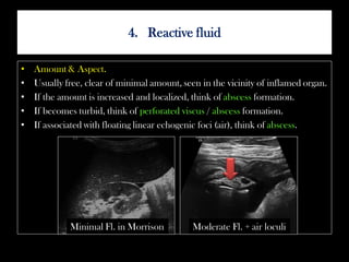 Emergency Ultrasound Course -Lecture 02 -Urgent sonographic signs -Part ...