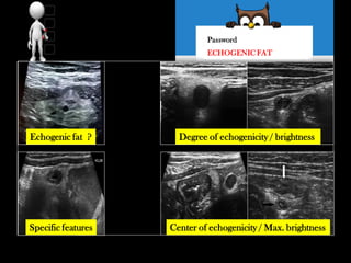Emergency Ultrasound Course -Lecture 02 -Urgent sonographic signs -Part ...