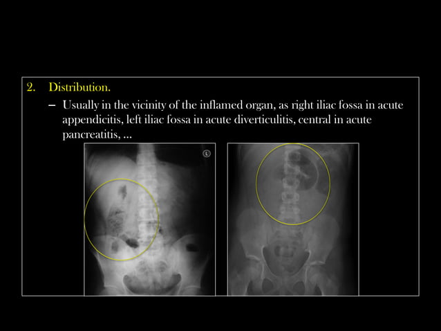 Emergency Ultrasound Course -Lecture 02 -Urgent sonographic signs -Part ...