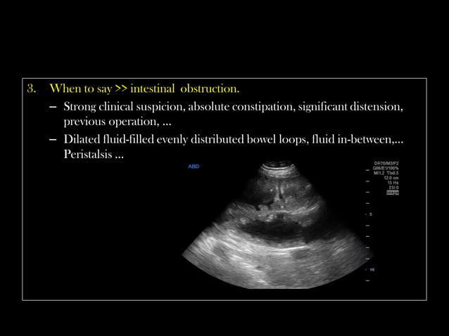 Emergency Ultrasound Course -Lecture 02 -Urgent sonographic signs -Part ...