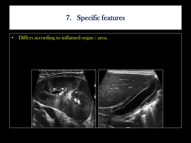 Emergency Ultrasound Course -Lecture 02 -Urgent sonographic signs -Part ...