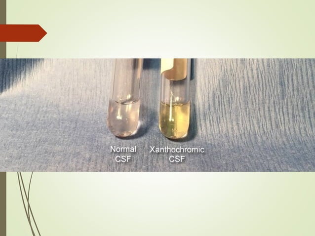 Lecture 04. CSF cerebrospinal fluid examination.ppt