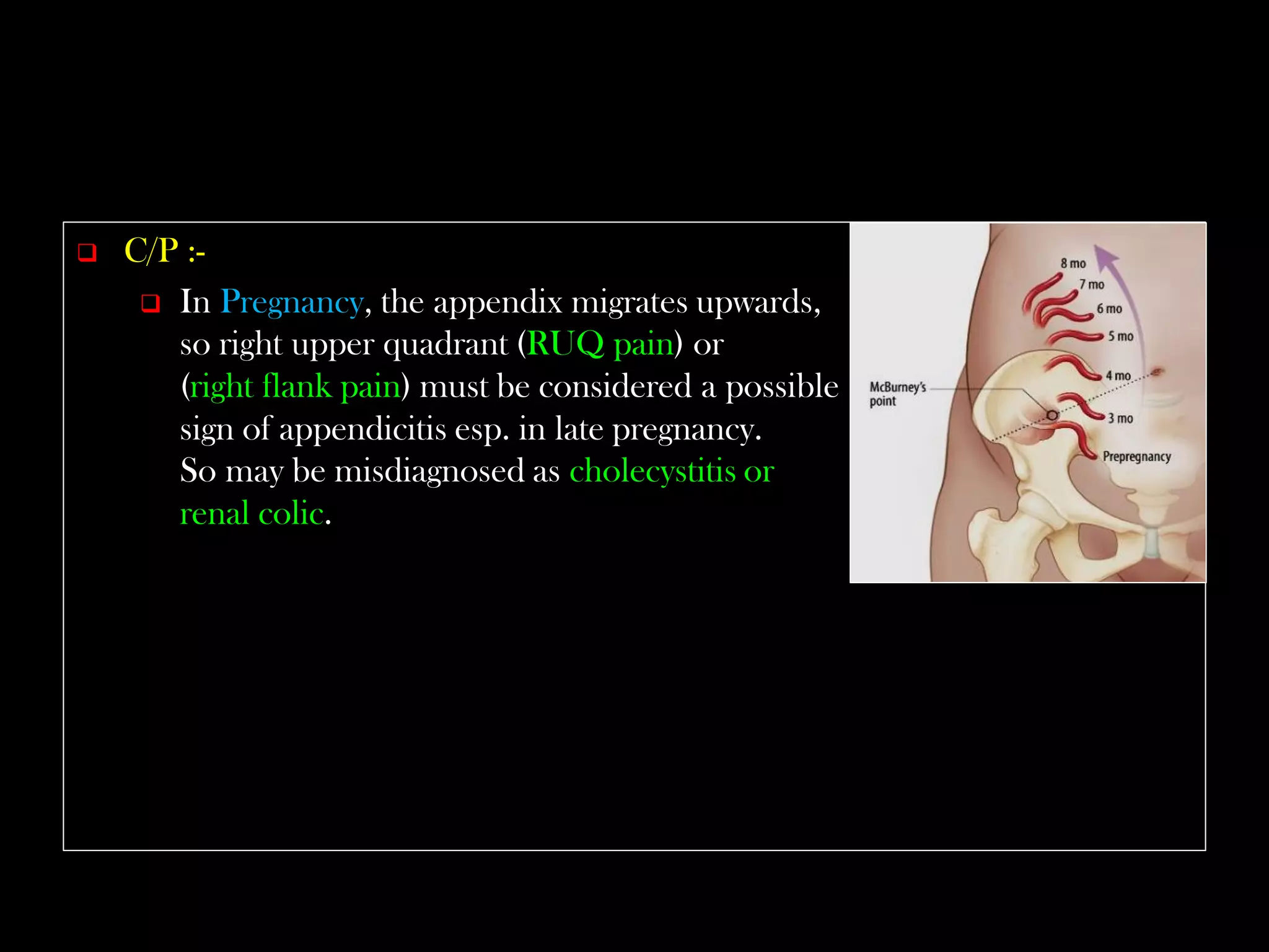 Emergency Ultrasound Course -Lecture 04 -Acute Appendicitis -Part 1 | PDF