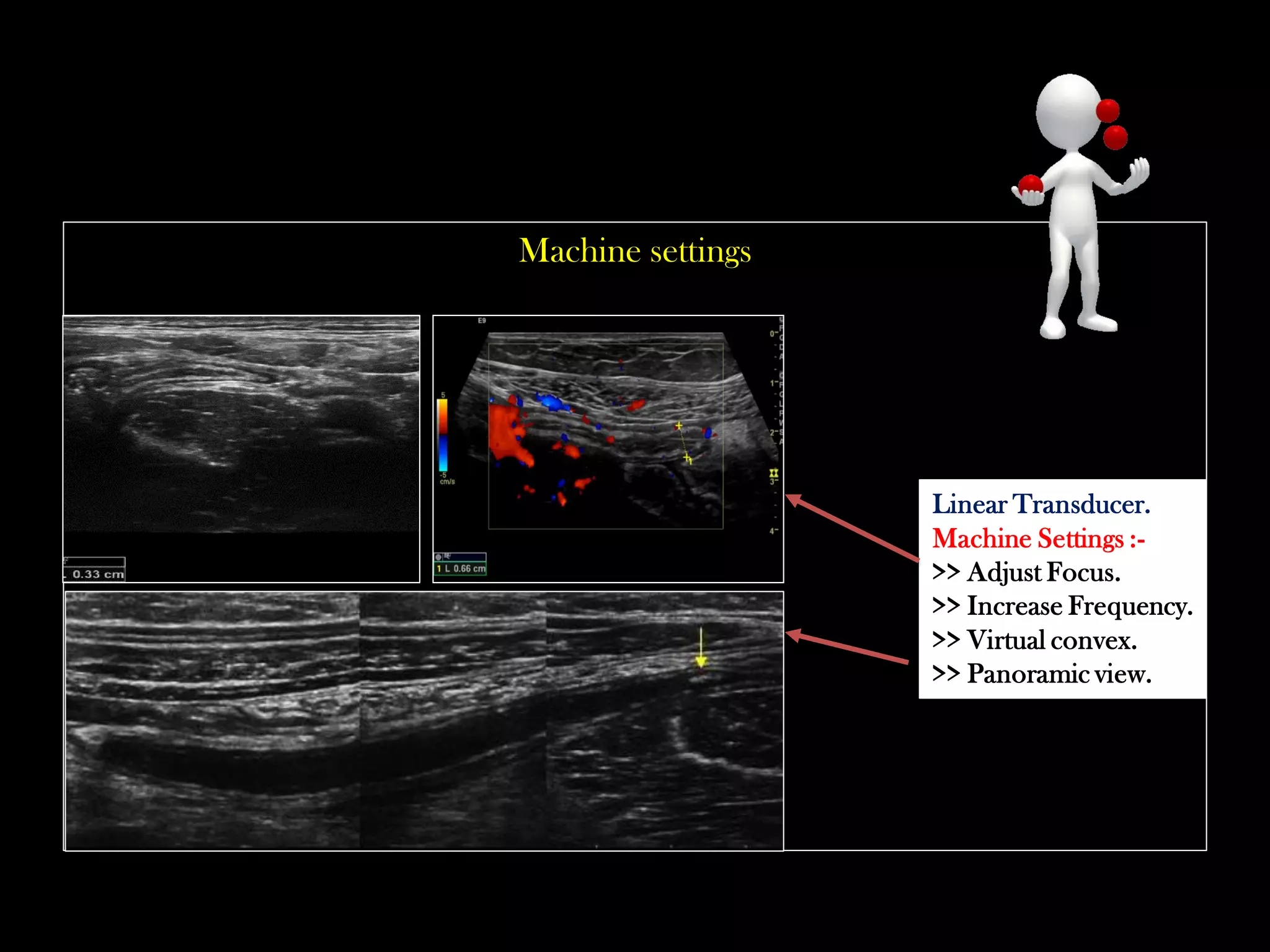 Emergency Ultrasound Course -Lecture 04 -Acute Appendicitis -Part 1 | PDF
