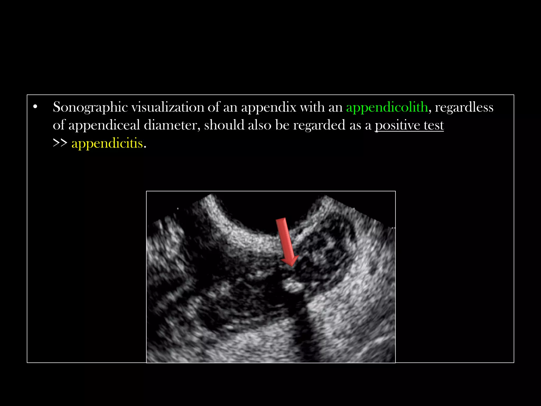 Emergency Ultrasound Course -Lecture 04 -Acute Appendicitis -Part 1 | PDF