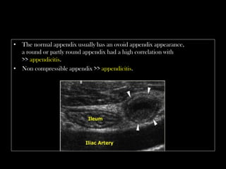 Emergency Ultrasound Course -Lecture 04 -Acute Appendicitis -Part 1 | PDF