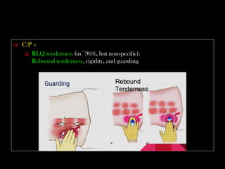 Emergency Ultrasound Course -Lecture 04 -Acute Appendicitis -Part 1 | PDF