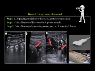 Graded Compression Ultrasound