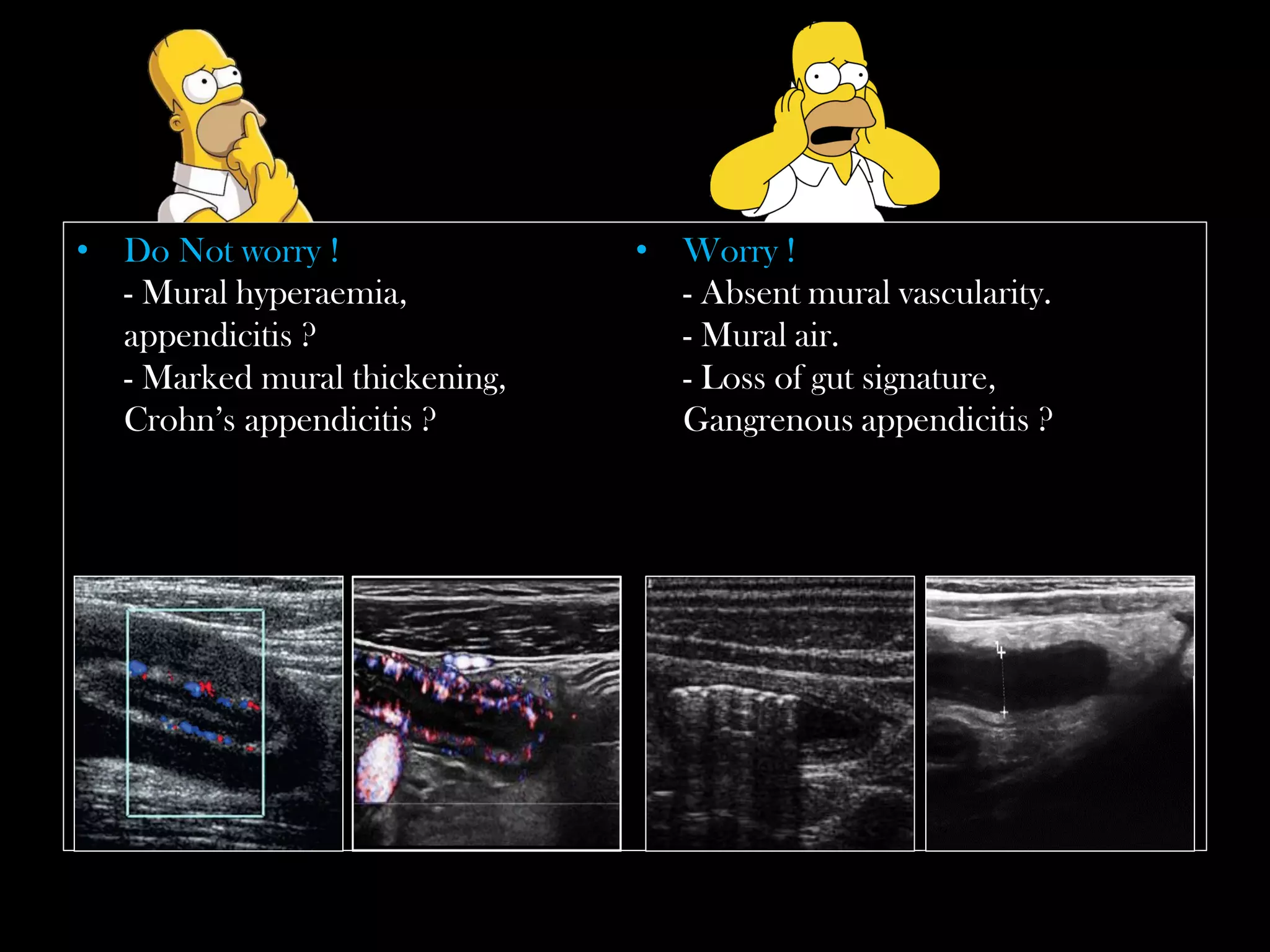 Emergency Ultrasound Course -Lecture 04 -Acute Appendicitis -Part 2 | PDF