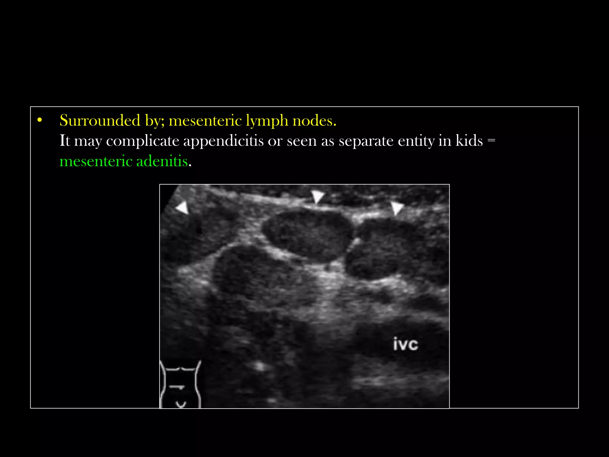 Emergency Ultrasound Course -Lecture 04 -Acute Appendicitis -Part 2 | PDF