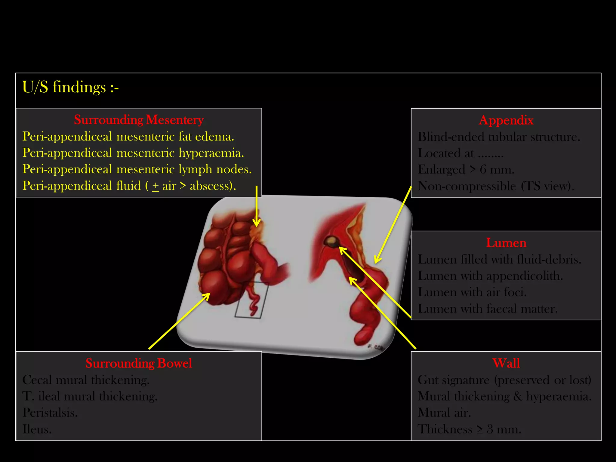 Emergency Ultrasound Course -Lecture 04 -Acute Appendicitis -Part 2 | PDF